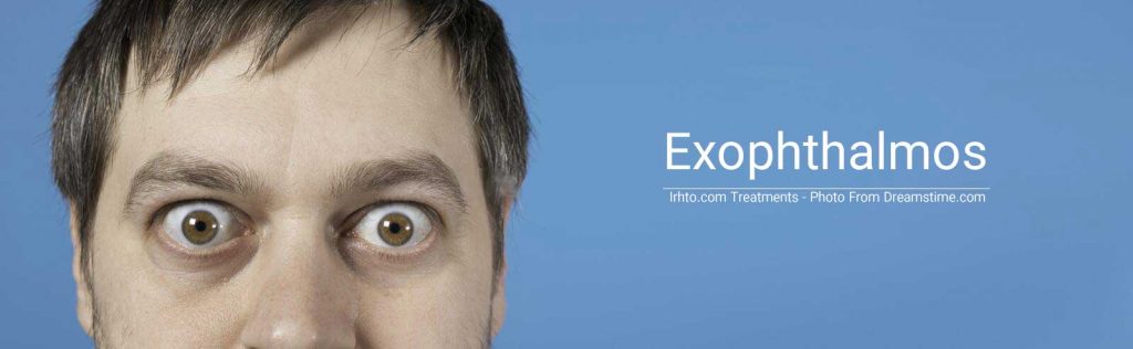 Exophthalmos - IRAN Health Tourism Organizer - Iran Medical Tourism - IRHTO