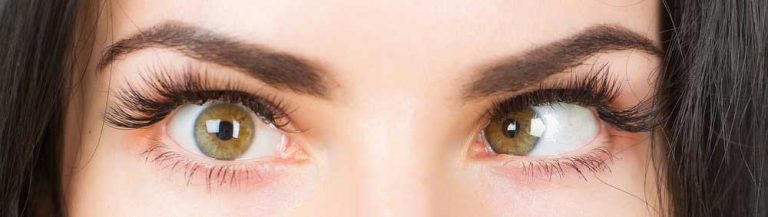 Misaligned Eyes (Strabismus) - IRAN Health Tourism Organizer - Iran ...